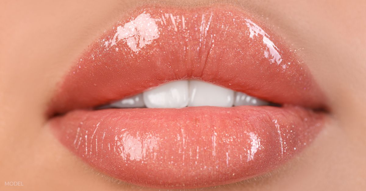 How To Make Lip Fillers Last Longer: Insider Tips for a Perfect Pout ...