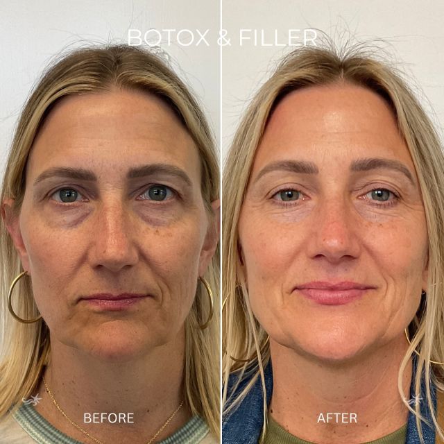 Best Med Spa in La Jolla & Carlsbad | La Jolla Cosmetic