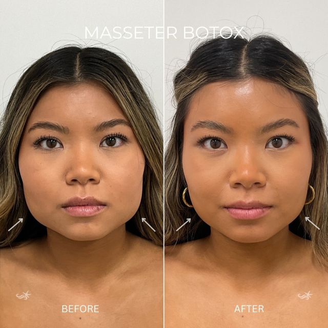 NovaThreads Before and After Photo Gallery | San Diego, Carlsbad, CA ...