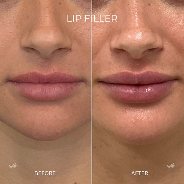 Meet Dr. Kiersten Riedler of Our Medical Spa in Carlsbad & La Jolla ...